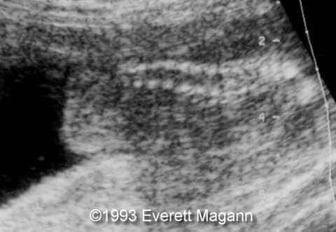 📃 Amelia near total