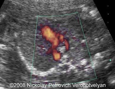 Case of the Week # 237