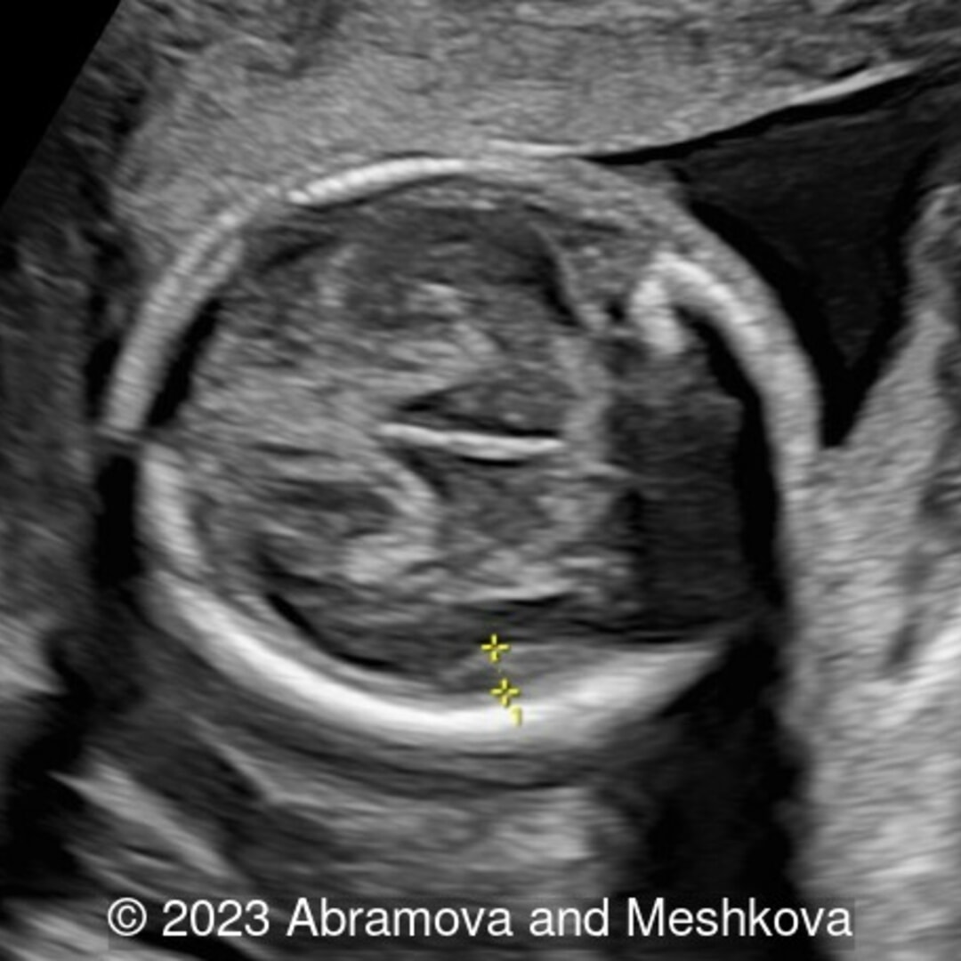 Case of the Week #576