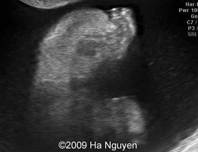 Case of the Week # 257