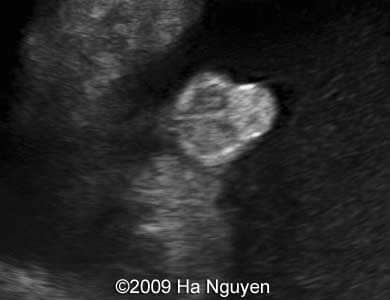 Case of the Week # 257