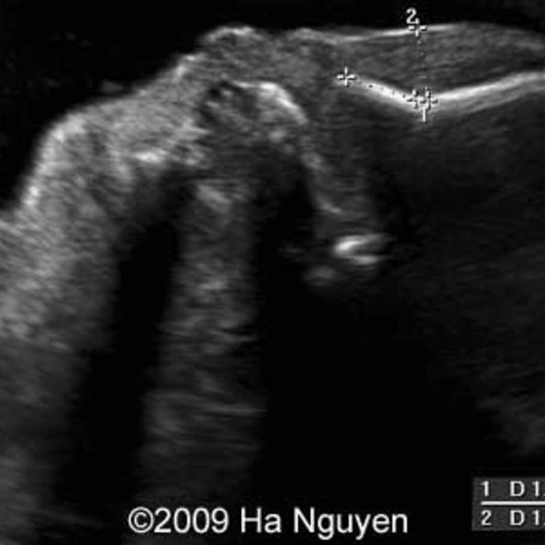 Case of the Week # 257