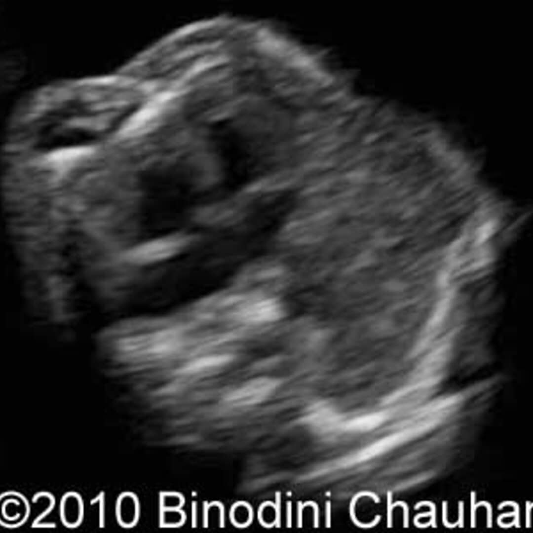 Case of the Week # 284