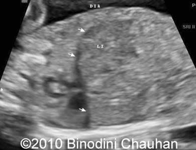 Case of the Week # 284