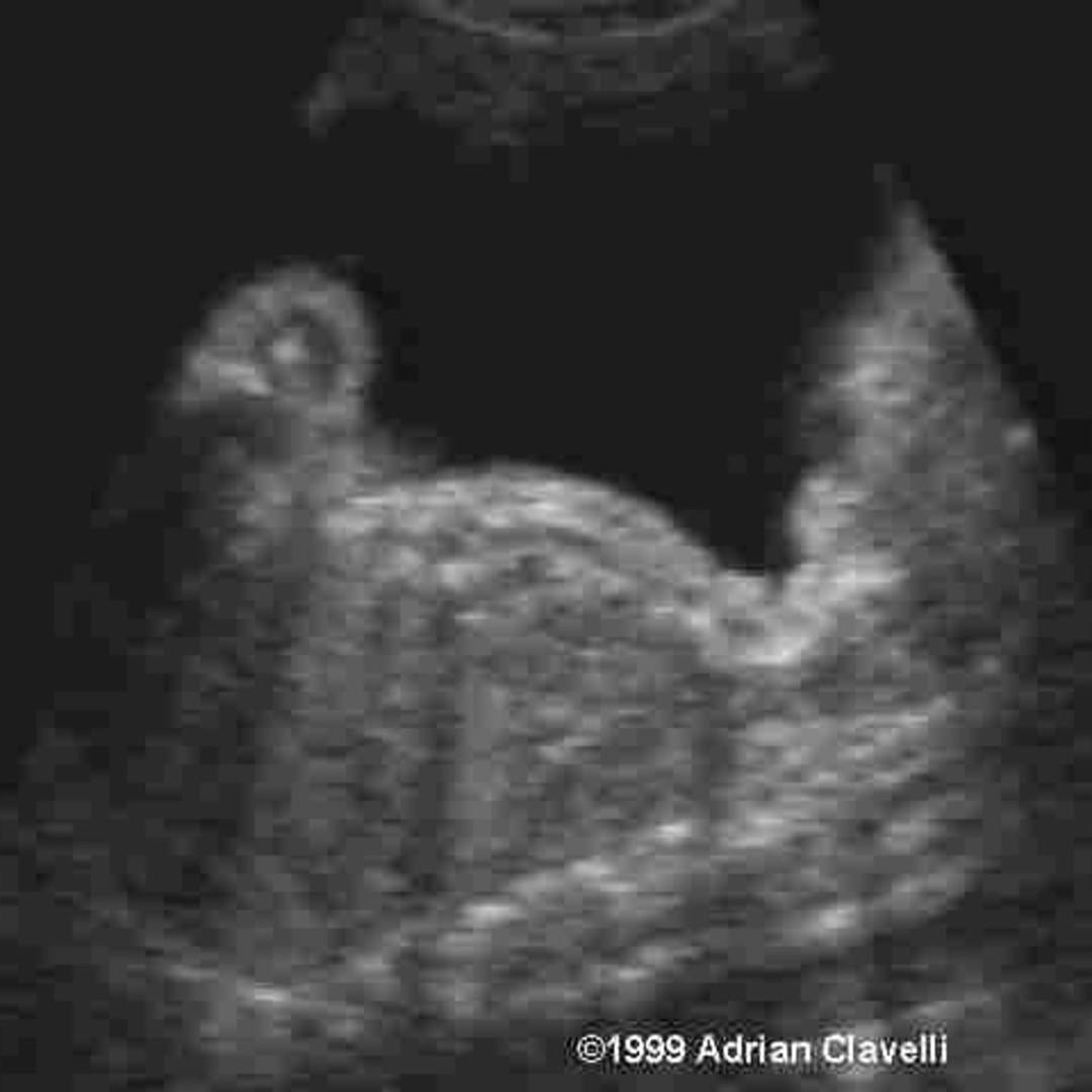 Case of the Week # 5