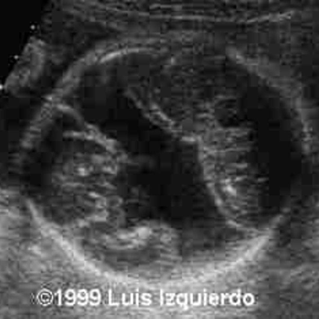 Case of the Week # 11