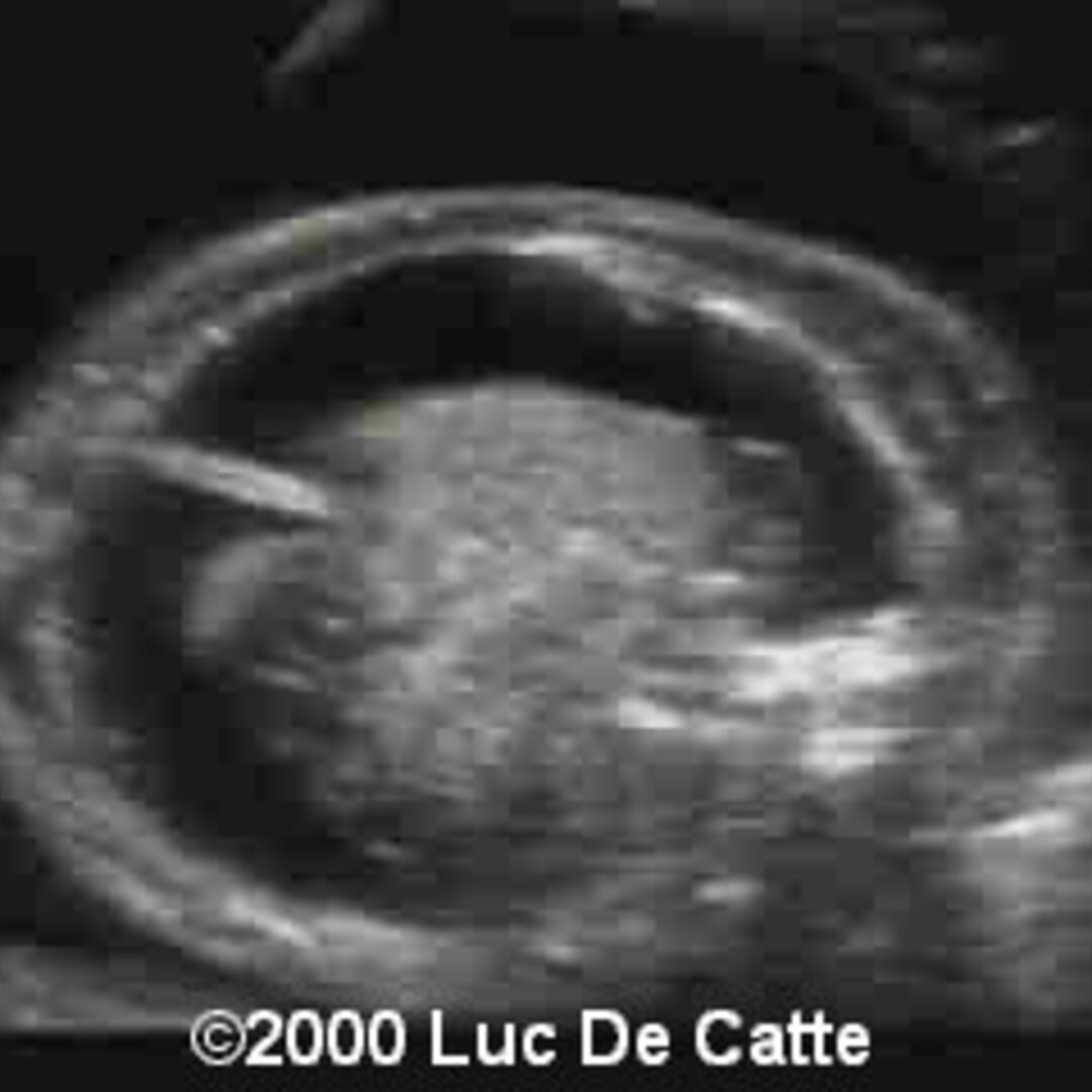 Case of the Week # 16