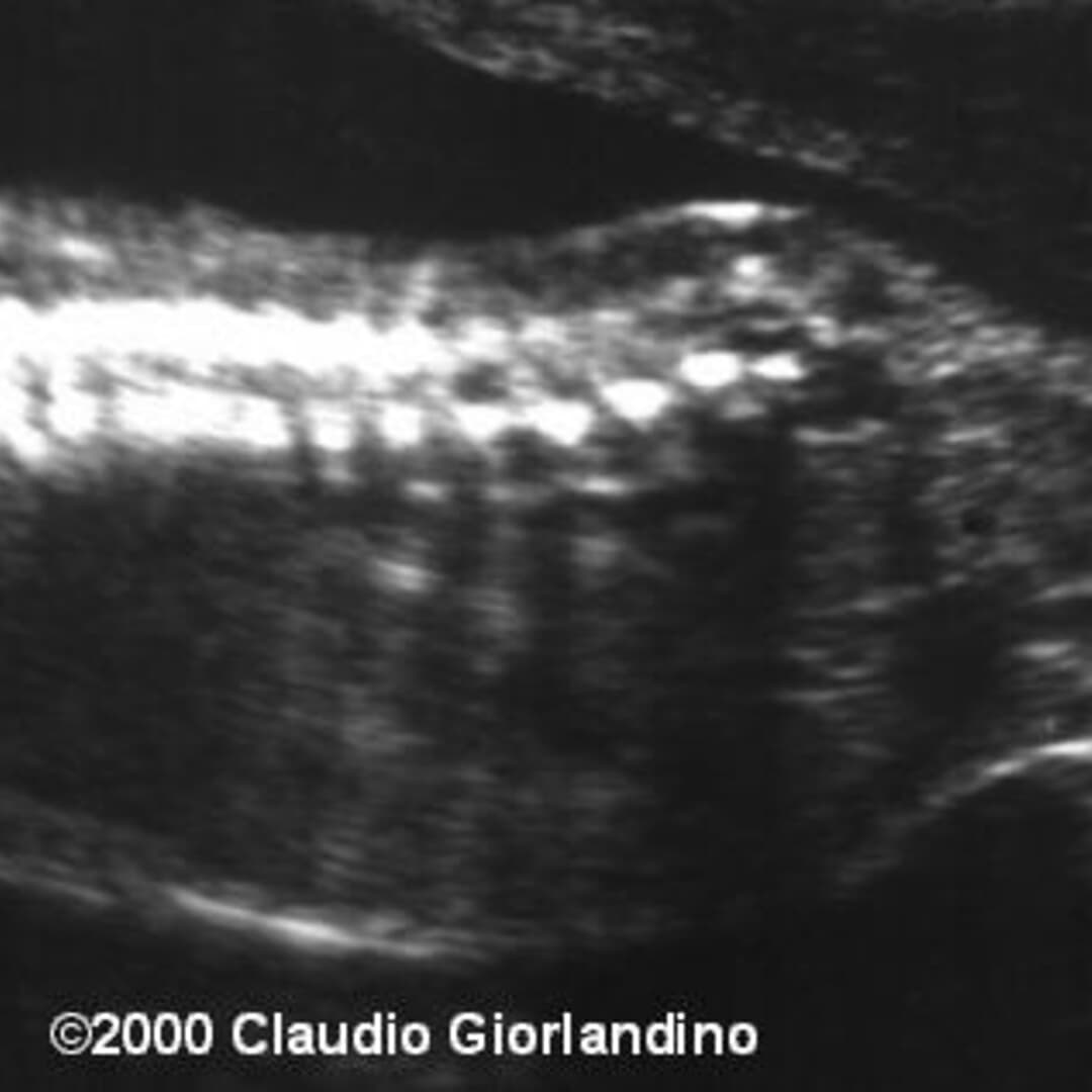 Case of the Week # 17