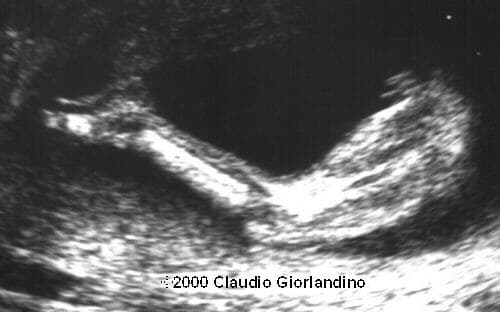 Case of the Week # 17