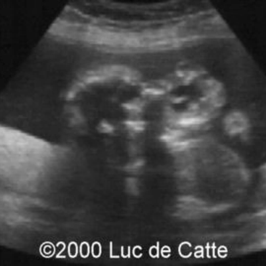 Case of the Week # 37