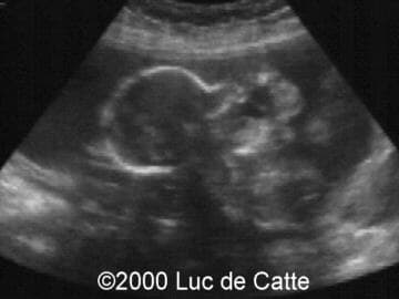 Case of the Week # 37