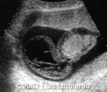 Case of the Week # 92