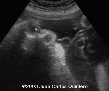 Case of the Week # 105