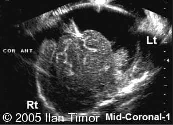 Case of the Week # 154