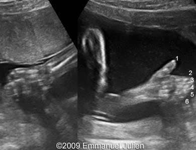Case of the Week # 263