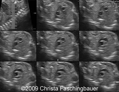 Case of the Week # 267