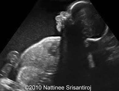 Case of the Week # 272