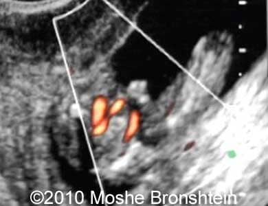 Case of the Week # 280