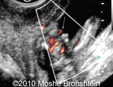 Case of the Week # 280