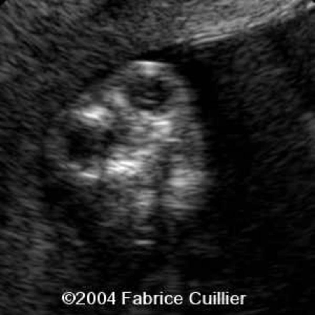 📃 Acrania, 3D rendering