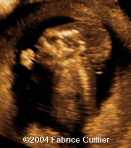 📃 Acrania, 3D rendering