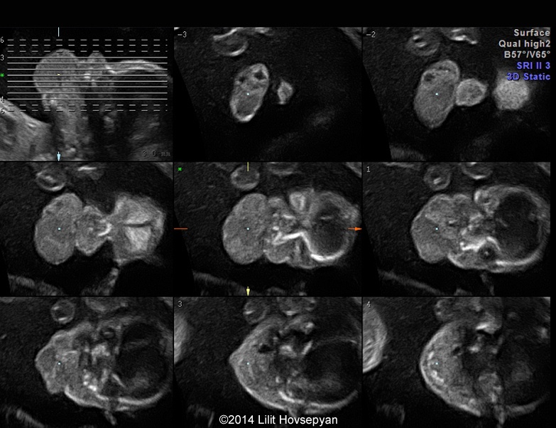 Case of the Week # 365