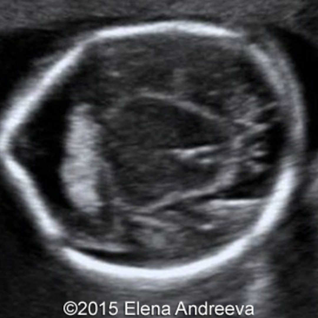 Case of the Week # 390