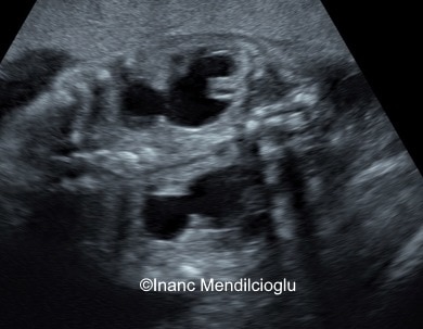 Case of the Week #526