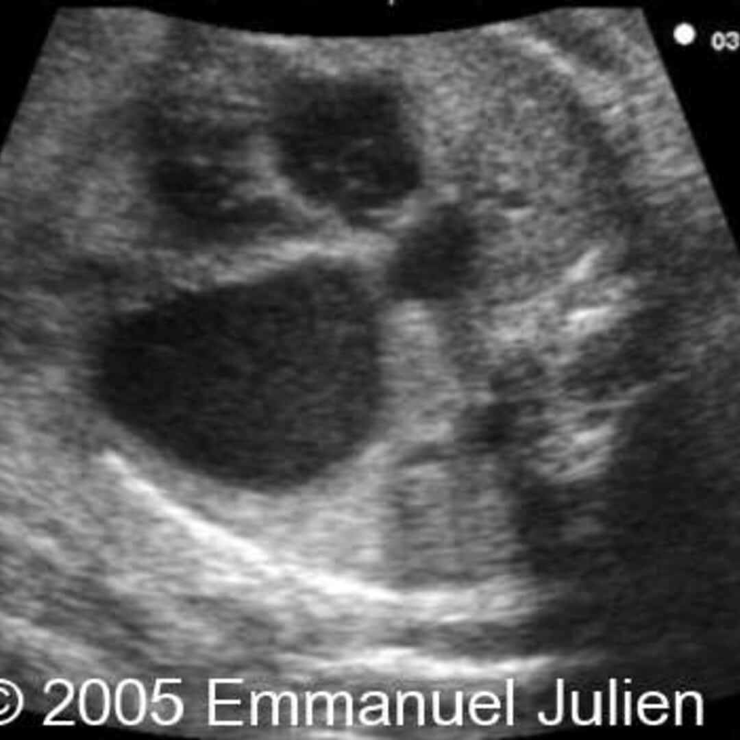 Case of the Week # 145