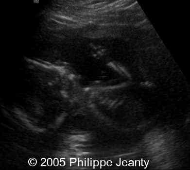 Case of the Week # 139