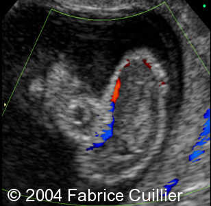 📃 Schisis-association