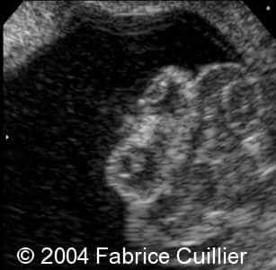 📃 Schisis-association