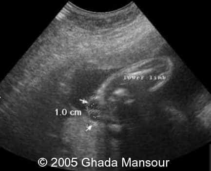 Case of the Week # 136