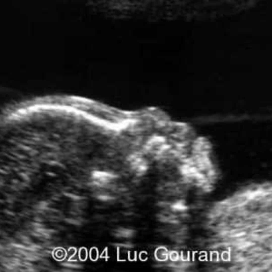 Case of the Week # 118