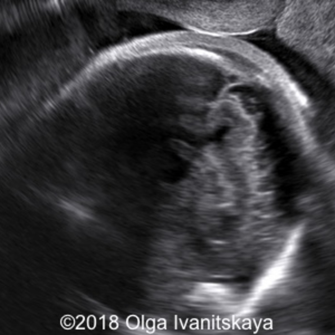 Case of the Week # 465