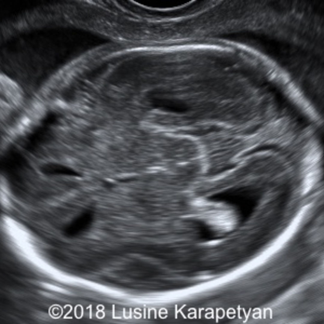 Case of the Week # 466