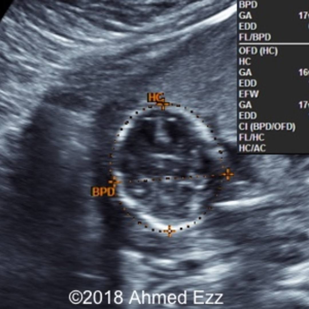 Case of the Week # 478