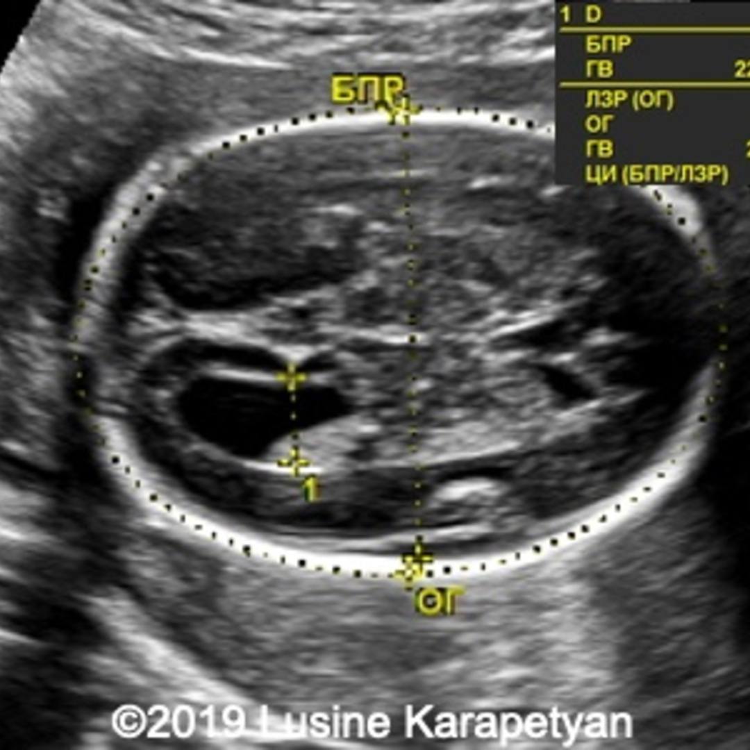Case of the Week # 498