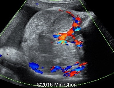 Case of the Week # 415