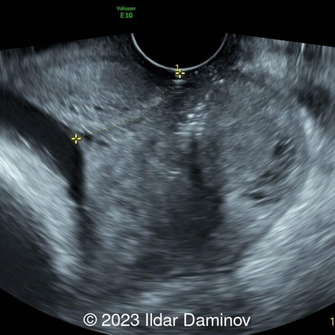 Case of the Week #588