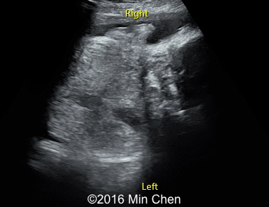 Case of the Week # 415