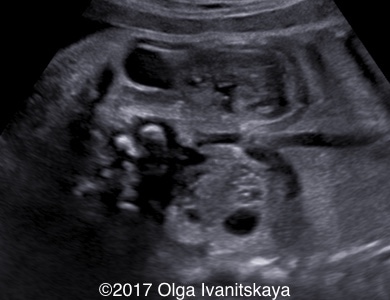 Case of the Week # 440