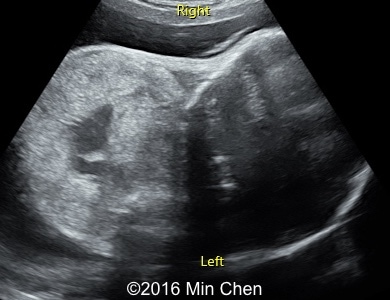 Case of the Week # 415