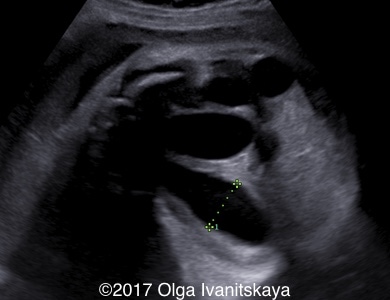 Case of the Week # 440