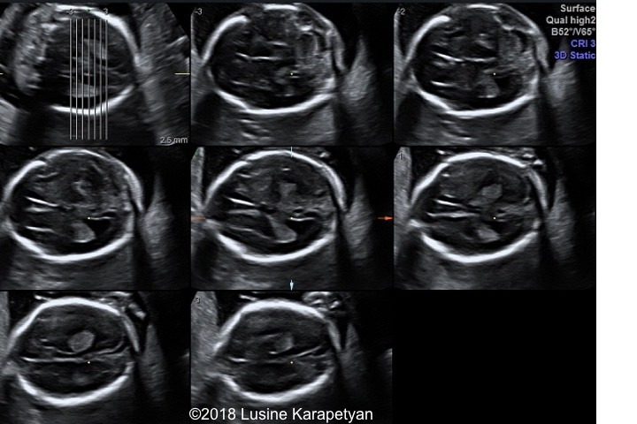 Case of the Week # 466