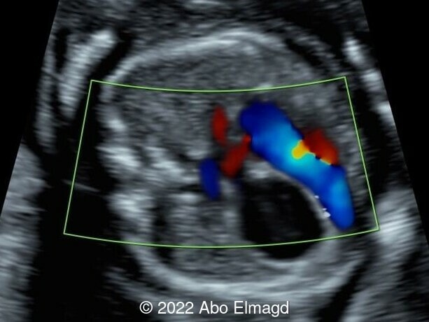 Case of the Week #569