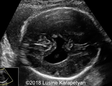 Case of the Week # 466