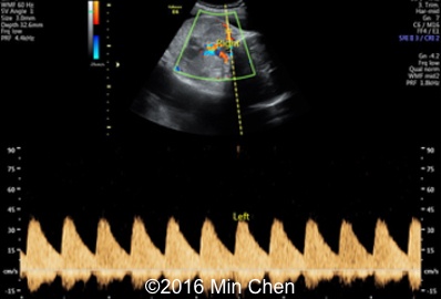 Case of the Week # 415