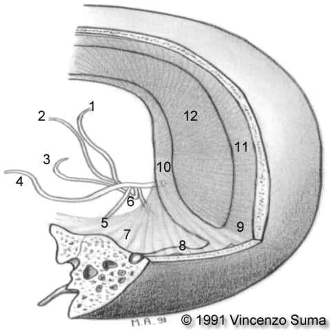 📃 Vein of Galen aneurysm