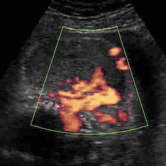 Case of the Week # 15